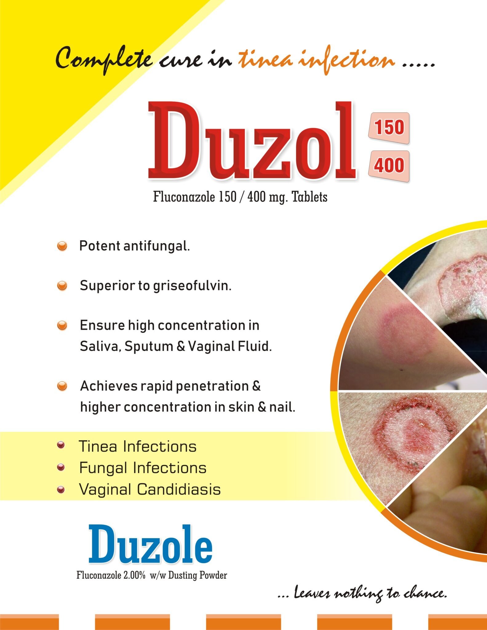 Duzol | Fluconazole Tablet